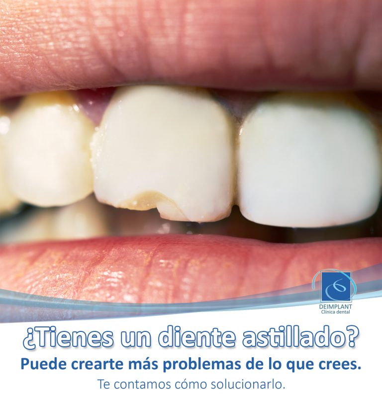 Diente astillado, complicaciones y tratamientos. - Clínica dental en ...